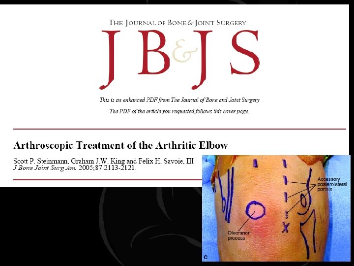 WHATS NEW IN ELBOWS Lee Van Rensburg May