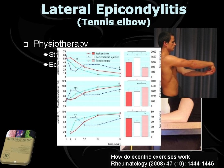 WHATS NEW IN ELBOWS Lee Van Rensburg May