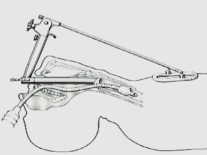LARINGE ANATOMIA LARINGEA Es un tubo hueco similar