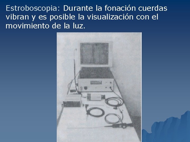 LARINGE ANATOMIA LARINGEA Es un tubo hueco similar