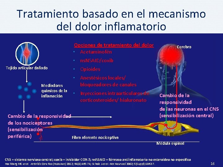 CONOCIENDO EL DOLOR ARTICULAR CRNICO Comit de desarrollo