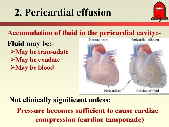 Pathophysiology L 6 Pathophysiology Of CVD Prof Fakhir