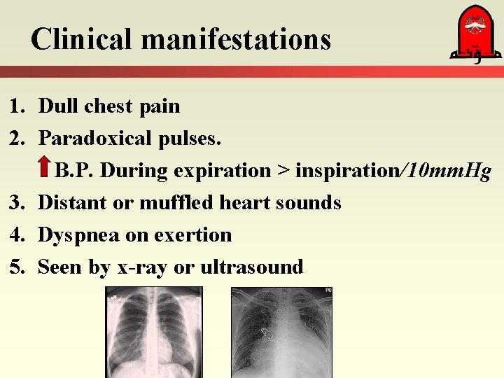 Pathophysiology L 6 Pathophysiology Of CVD Prof Fakhir