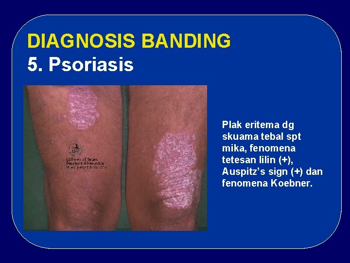 by Dr Sari Handayani Pusadan Sp KK M