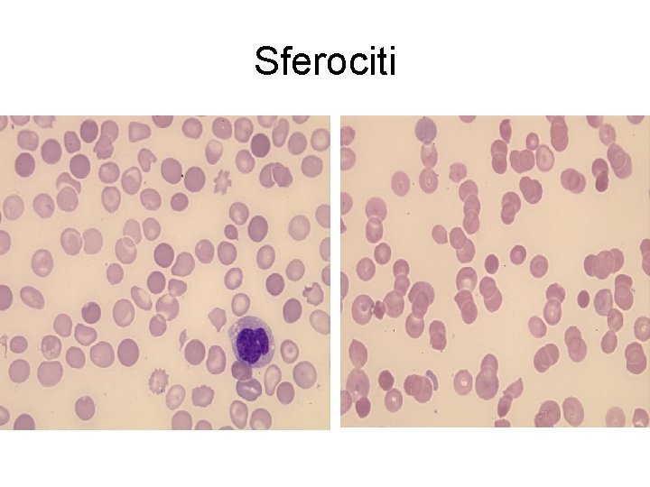 Eritrociti 6 8 u Stanice bez jezgre Crvenkasta
