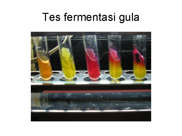 DIAGNOSIS LABORATORIUM UNTUK INFEKSI BAKTERI Dr ROSLAILI RASYID