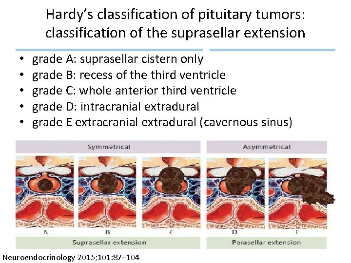 Non functioning pituitary adenomas nonfunctioning pituitary ...