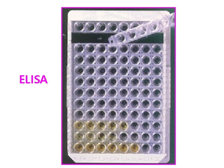 Immunoassay Precipitation Manual Double immunodiffusion Automation ...