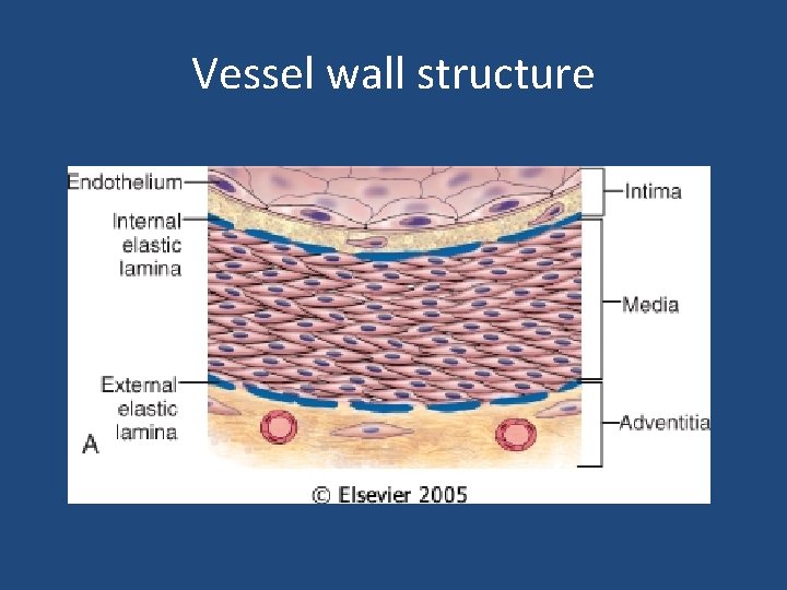 Atherosclerosis Hisham Al Khalidi Vessel wall structure Atherosclerosis