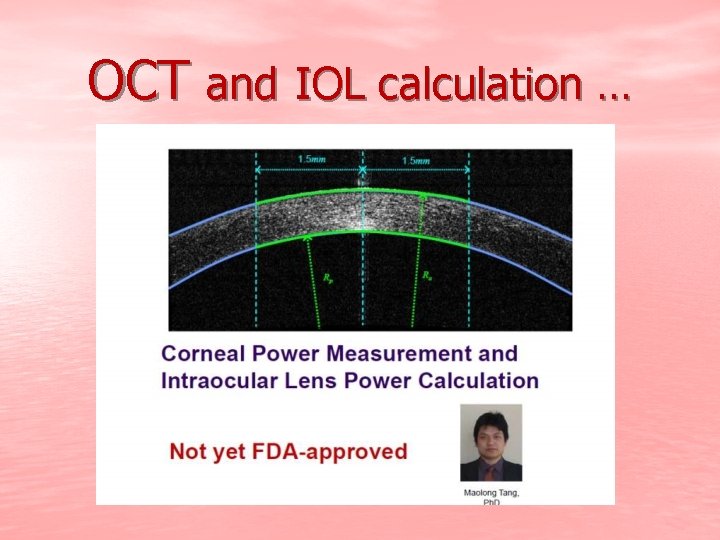 Optical Coherence Tomography Ultrasound Bio Microscopy of the
