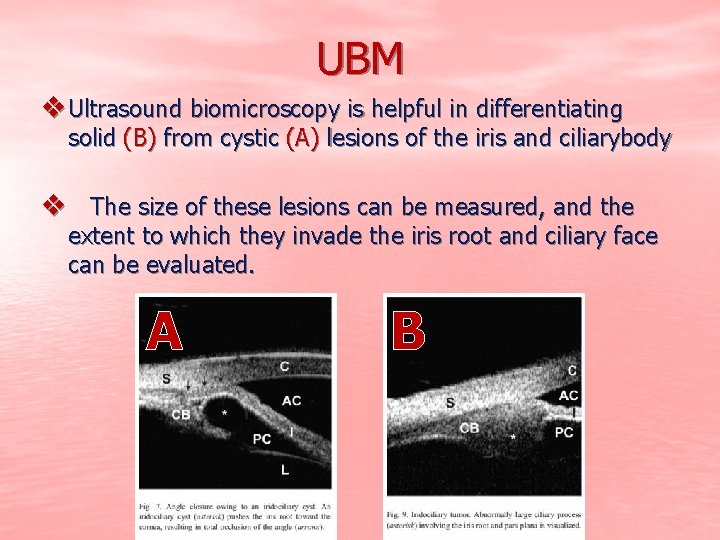 Optical Coherence Tomography Ultrasound Bio Microscopy of the