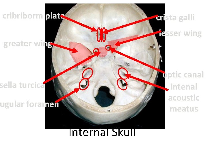 Bones and cavities of the facial cranium TMJ