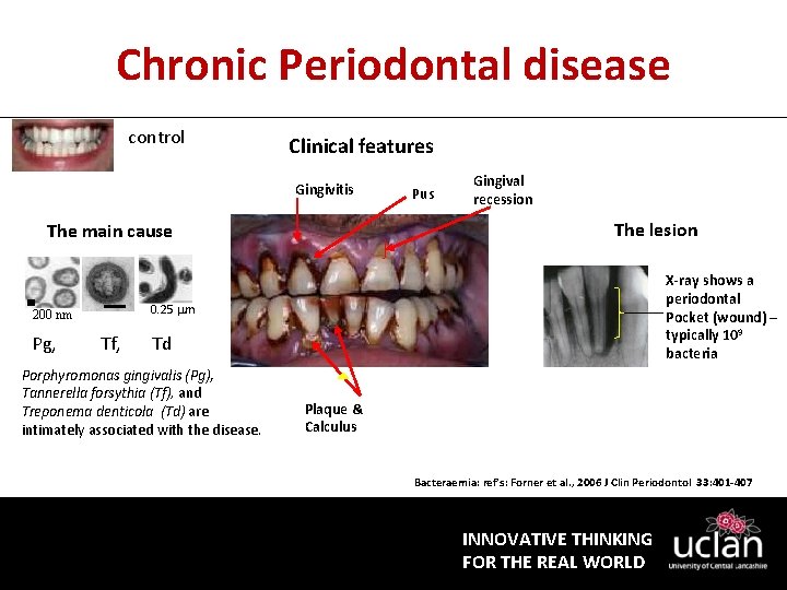 Preliminary evidence for a link between periodontal disease