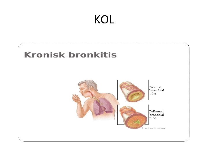 Respiration og kol Definition respiration Respirationen er den
