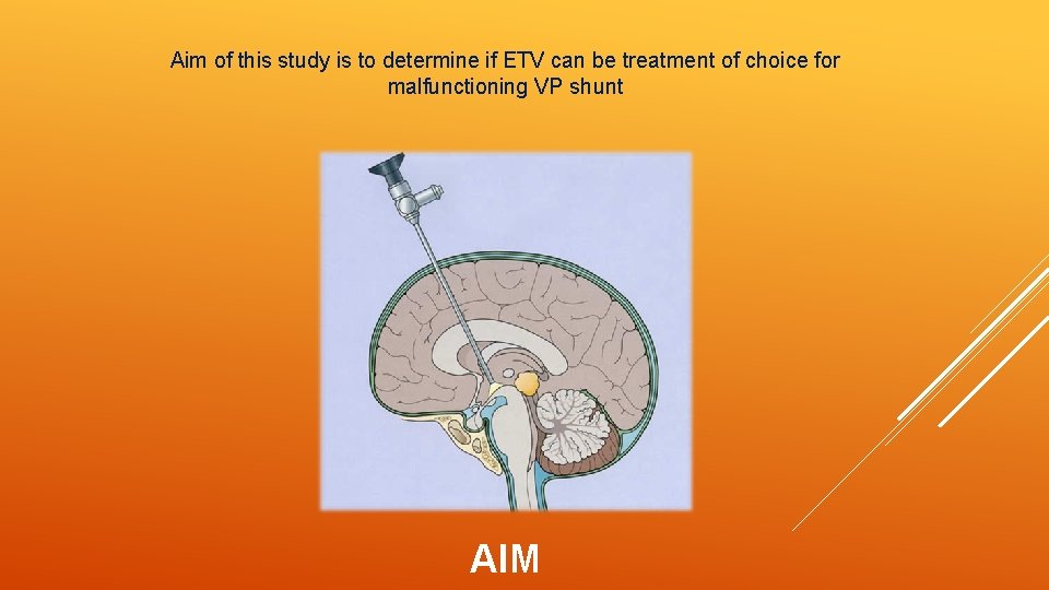 BENEFIT OF ENDOSCOPIC THIRD VENTRICULOSTOMY FOR MALFUNCTIONING ...