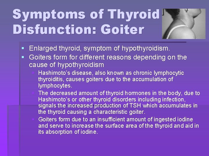 Thyroid and Anti Thyroid Drugs An overview of