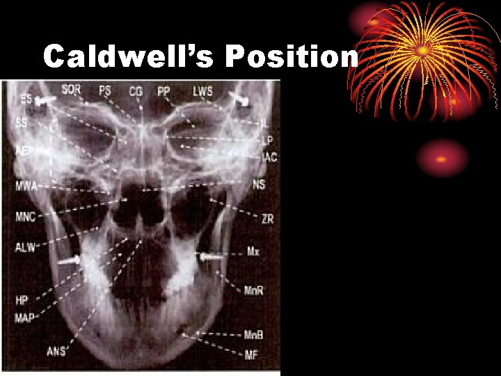 RADIOLOGI MUSKULOSKELETAL Dr Rozetti Sp Rad BAGIAN RADIOLOGI