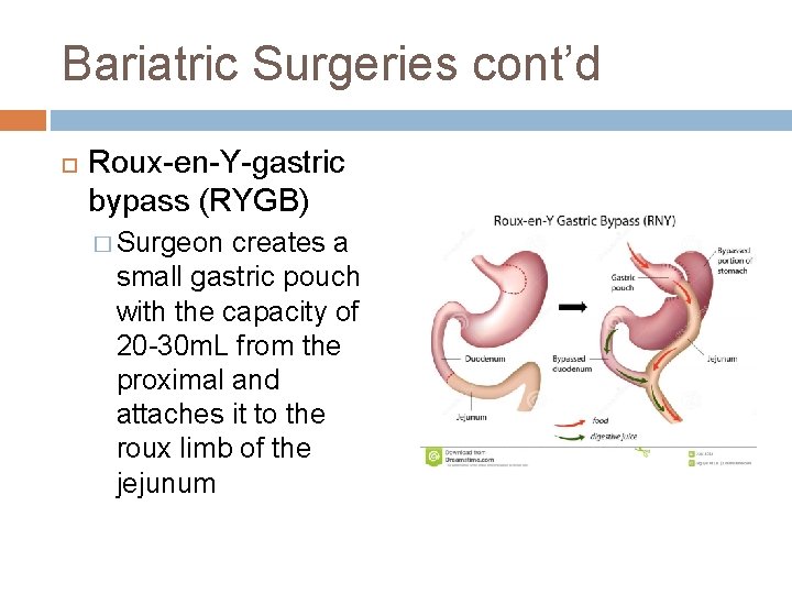 PROVIDING NUTRITION SUPPORT AFTER BARIATRIC SURGERY Presented by