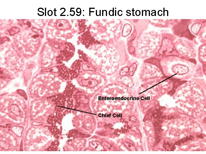 Slot 4 1 Submandibular left and sublingual right