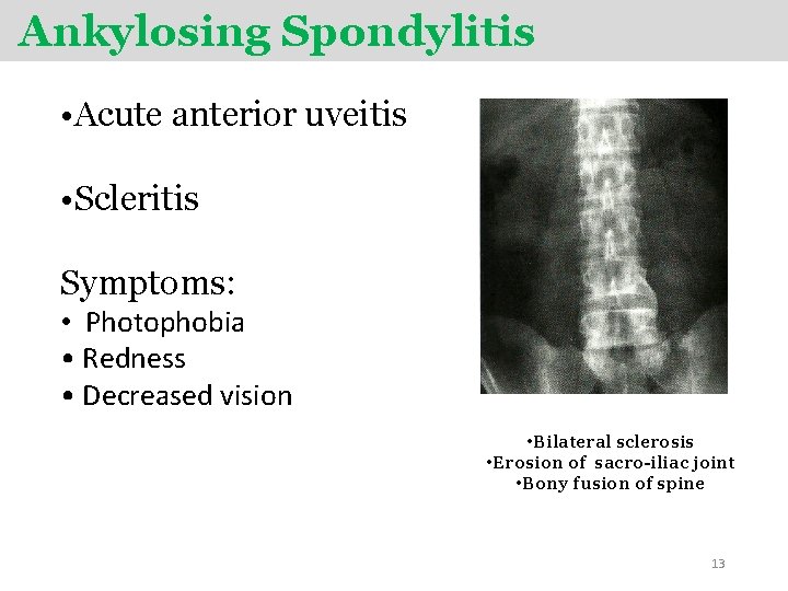 Ocular Manifestations of Systemic diseases Dr Ajai Agrawal