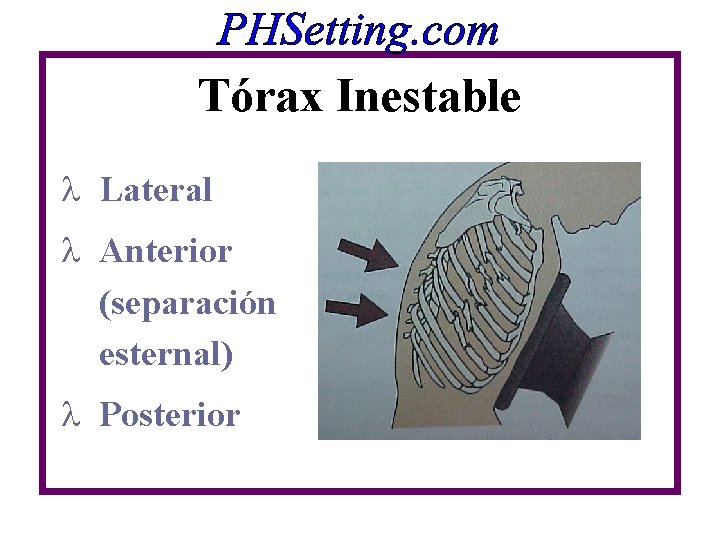 Trauma Torcico LESIN TORCICA HIPOXIA TISULAR Oxigenacin inadecuada