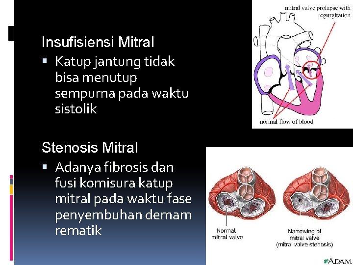 TERMINOLOGI MEDIS II Patologi Sistem SirkulasiKardiovaskuler By Sarah