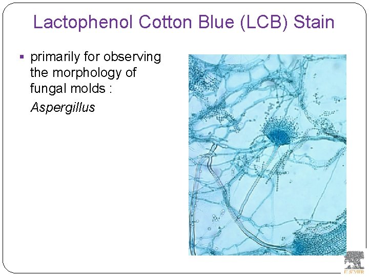 YEDTEPE UNIVERSITY YEDTEPE SCHOOL OF MEDICINE Laboratory Diagnosis