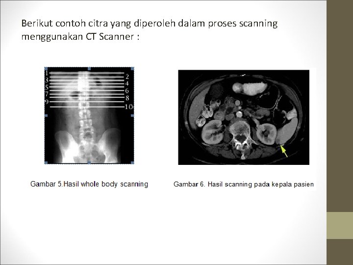 CT SCAN Winda Wirasa ST MT Definisi Merupakan