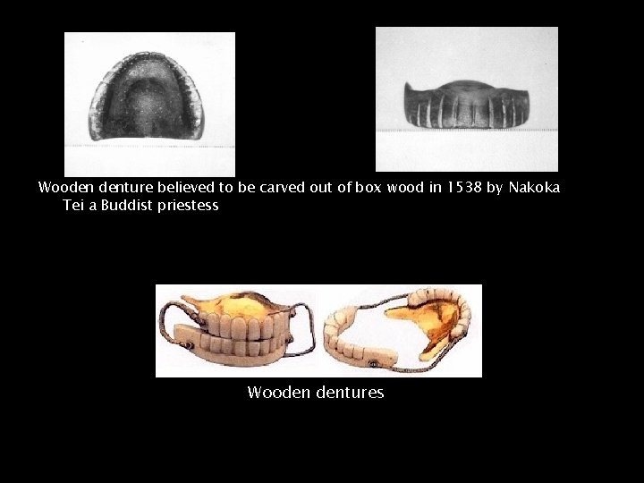 DENTURE BASE RESINS PART 1 Dr lakshya kumar