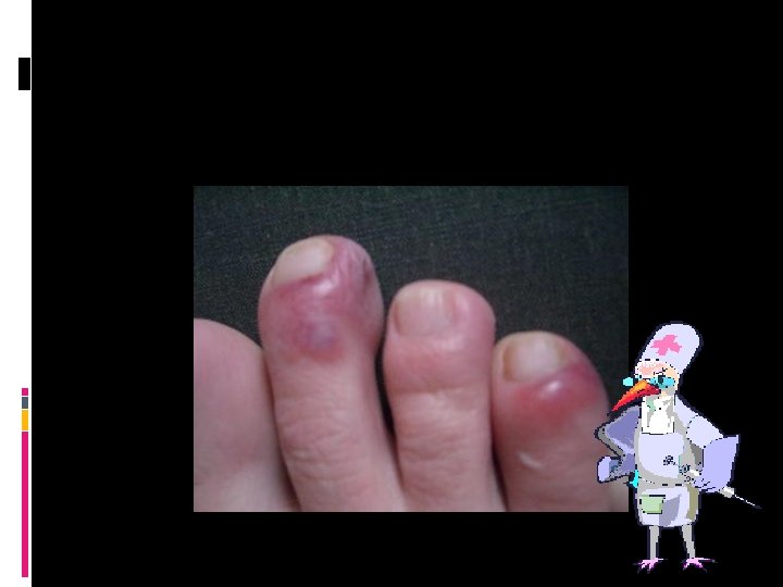 PHLEGMON By Dharmendra Singh Group no 317 Phlegmon