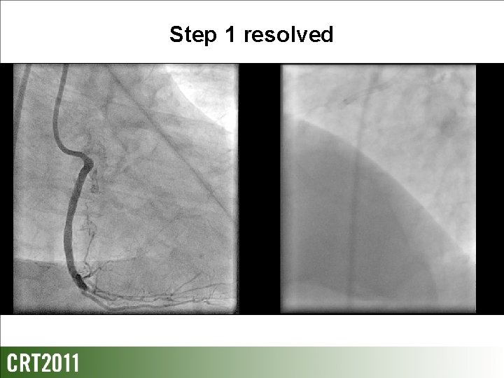 Advanced CTO Techniques Gerald S Werner MD Ph