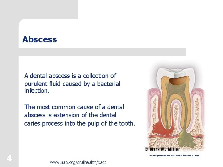 Protecting All Childrens Teeth Common Oral Pathology 1