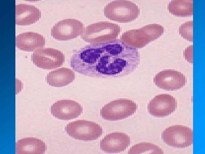 Staining of Blood Smear Romanowsky stain Romanowsky stainEosin