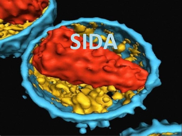 SIDA Qu es el SIDA Virus inmunodeficiencia adquirida