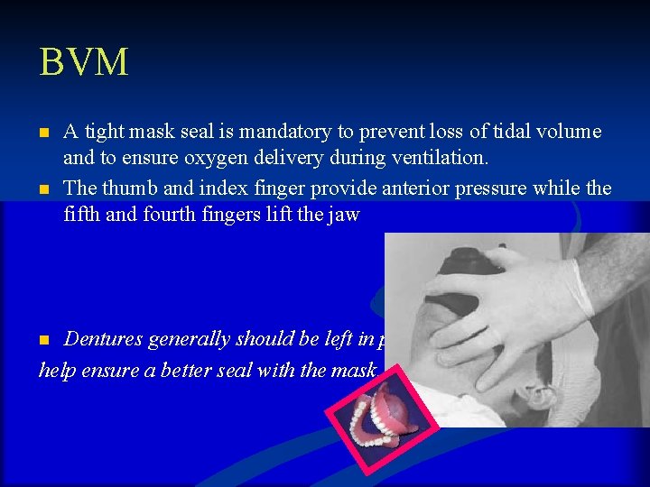 What are the indications of intubations n n