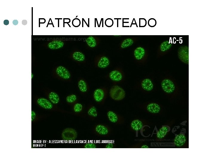 CASO CLNICO 17 ANA SANTO QUILES PACIENTE y