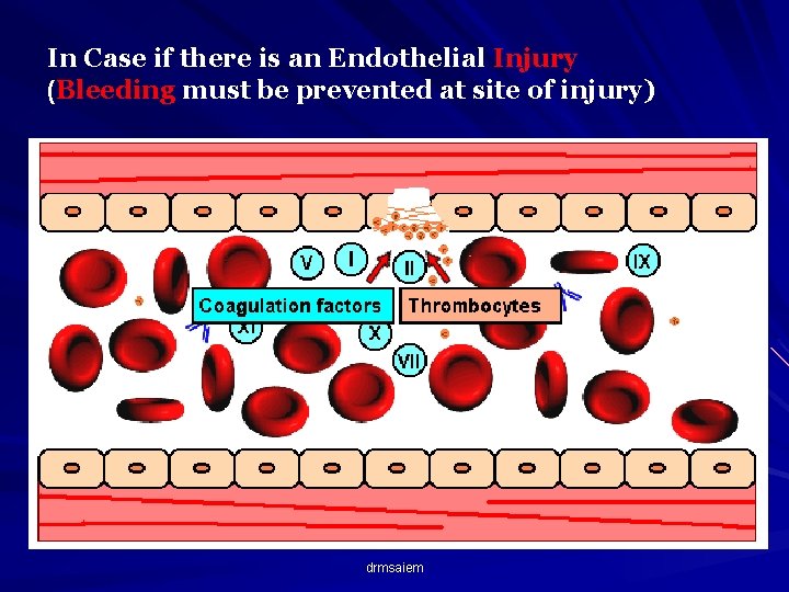 HEMOSTASIS Damaged Blood Vessels On vessel injury Vasoconstriction
