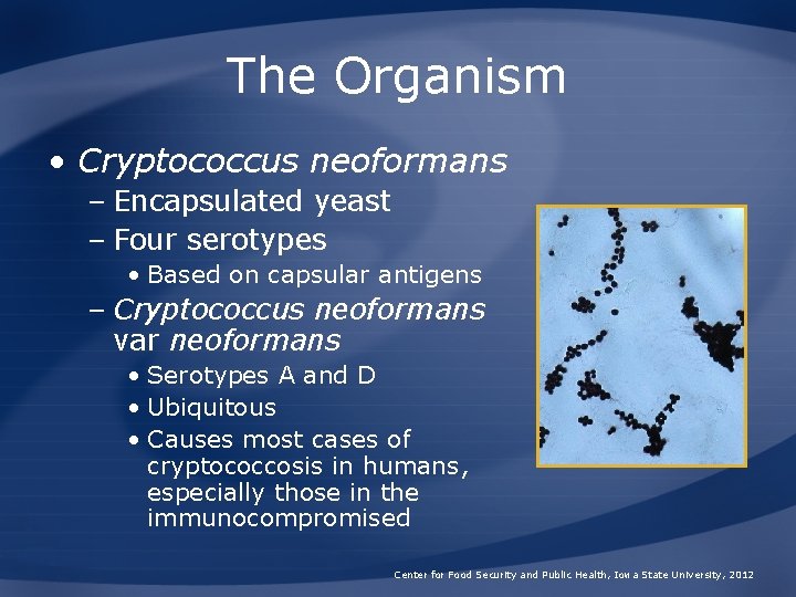 Cryptococcosis Torulosis European blastomycosis BusseBuschkes disease ...
