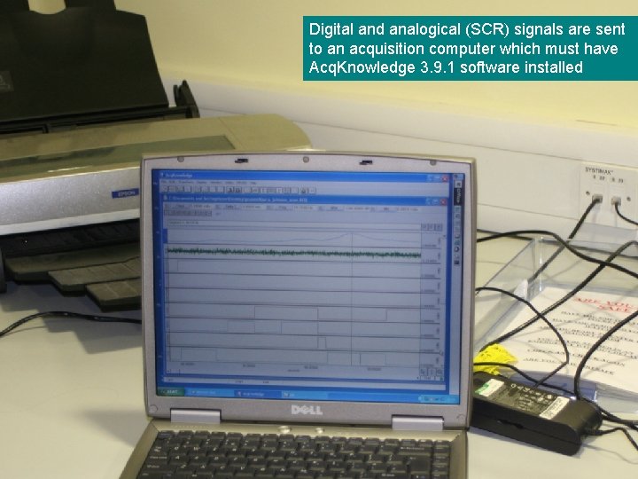f MRI compatible SCR recording For the CBU