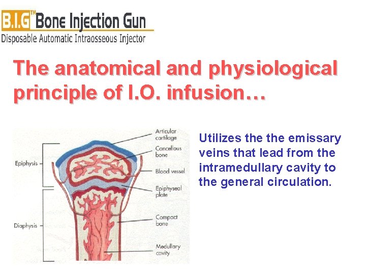 Objectives of this presentation Historical background of intraosseous