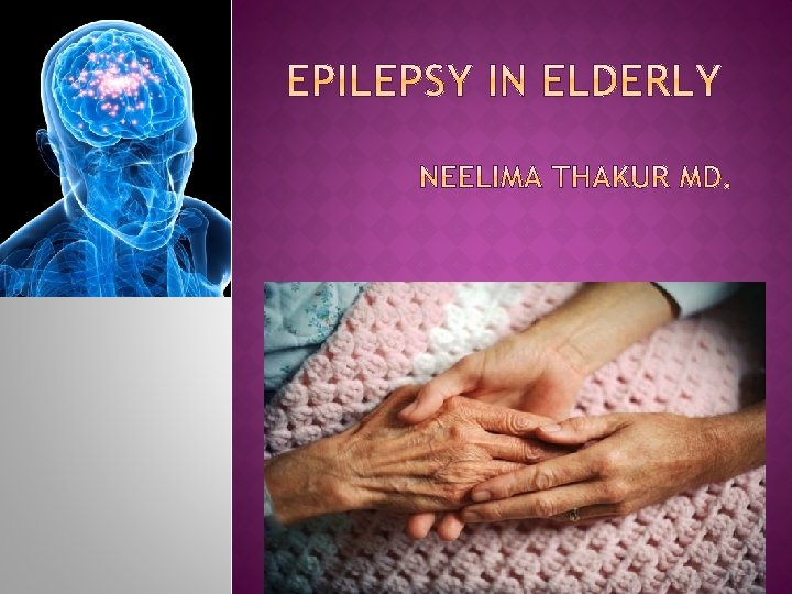 Research shows that the incidence of epilepsy is