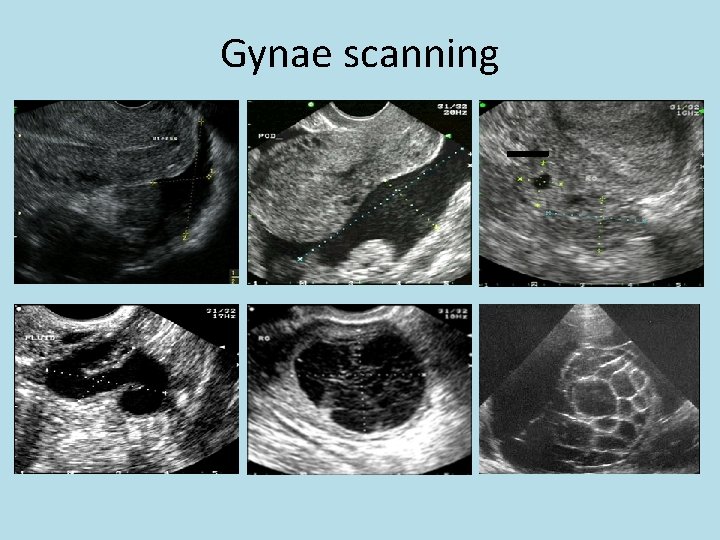 Gynaecology Emergencies in Primary Care Mr Philip Kaloo