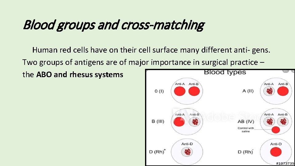 What is transfusion It is Intravenous administration of