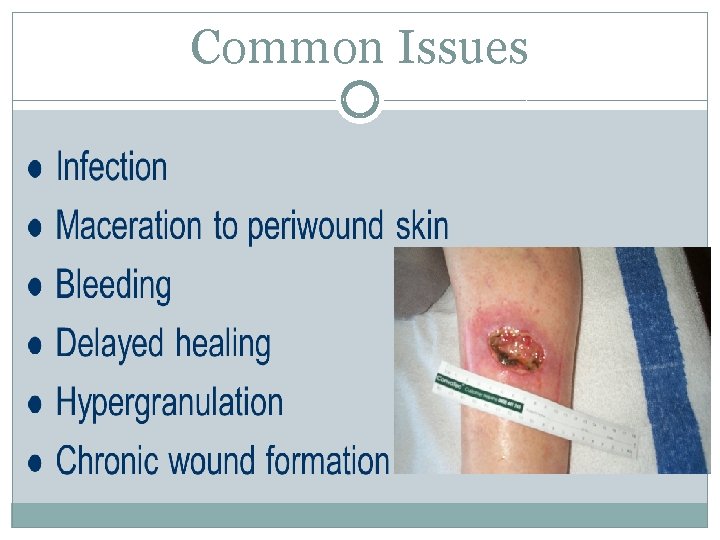 Assessment and management of skin tears SARA BEST