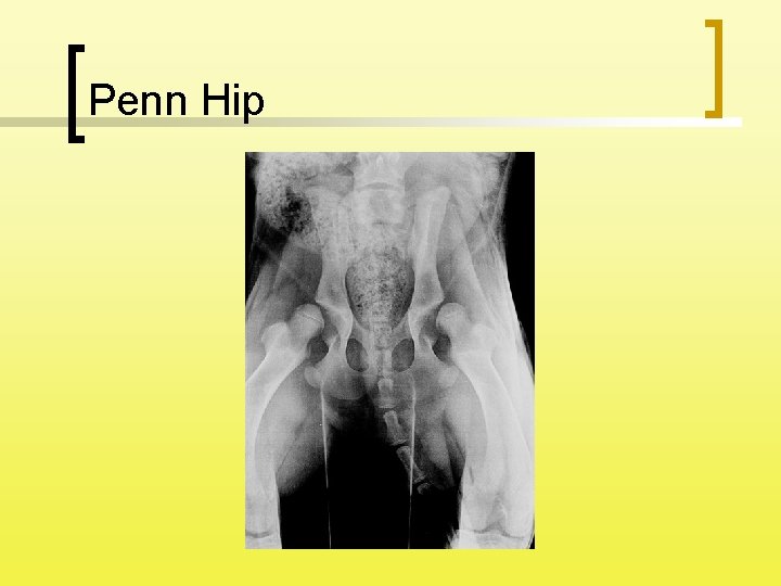Wojciech Atamaniuk Diagnostyka dysplazji stawu biodrowego i okciowego