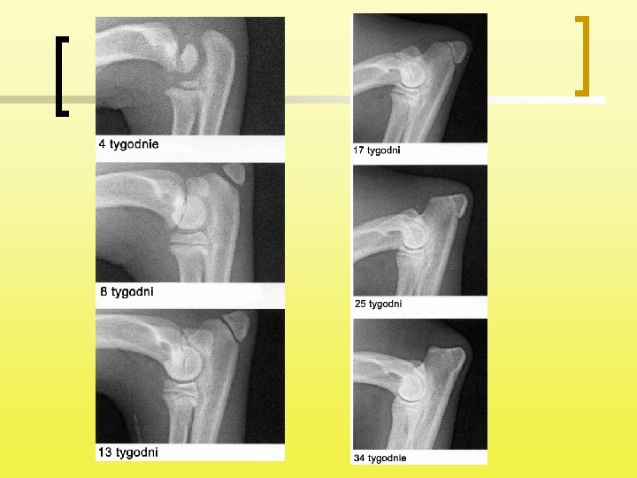 Wojciech Atamaniuk Diagnostyka dysplazji stawu biodrowego i okciowego