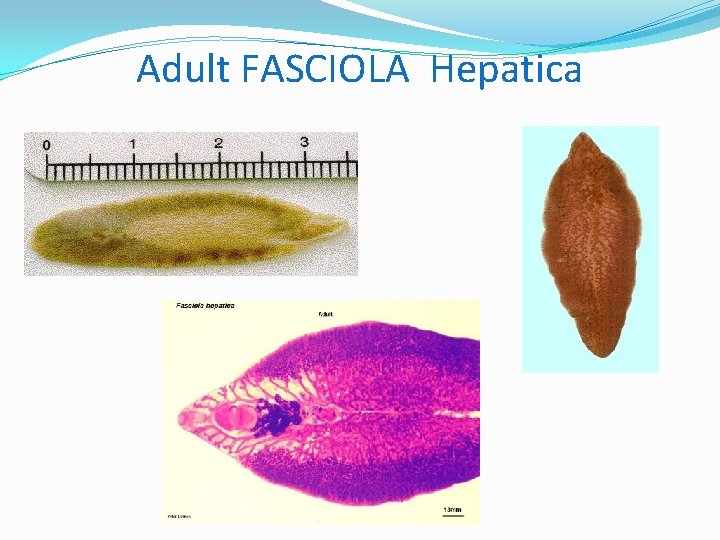 FASCIOLA HEPATICA FASCIOLA hepatica Disease Fascioliasis liver rot