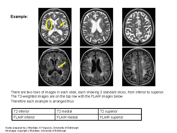 20 standard MR scans with validated ratings on