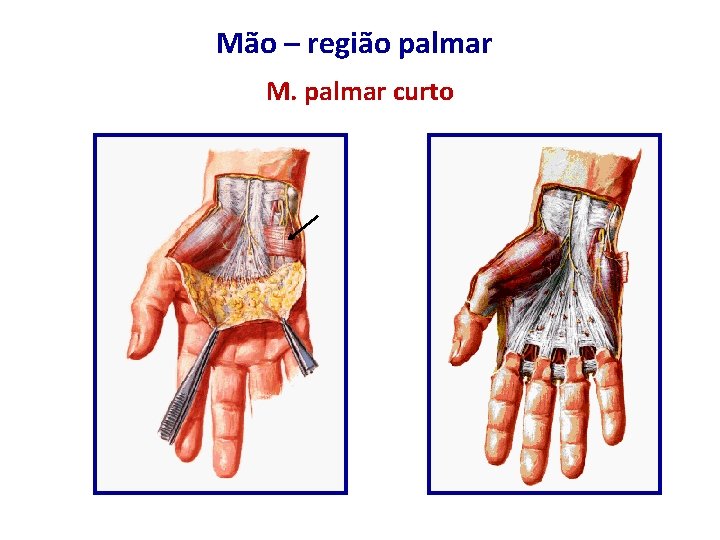 ANATOMIA TOPOGRFICA DOS MEMBROS SUPERIORES AULA 5 Msculos