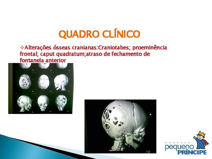 CURSO DE EDUCAO CONTINUADA EM CIRURGIA PEDITRICA CIPERJCREMERJ